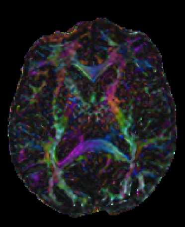 DTI Visualizaton Project