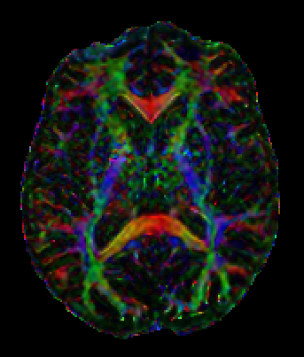 DTI Visualizaton Project