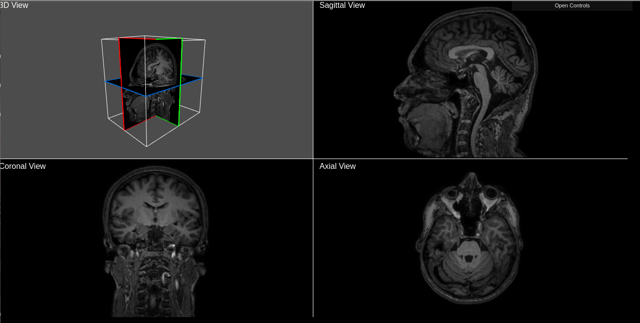 DTI Visualizaton Project
