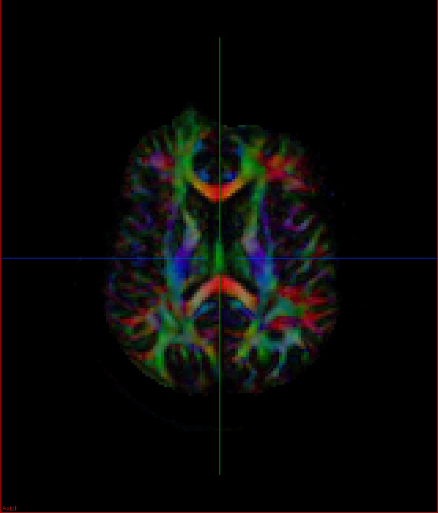 DTI Visualizaton Project