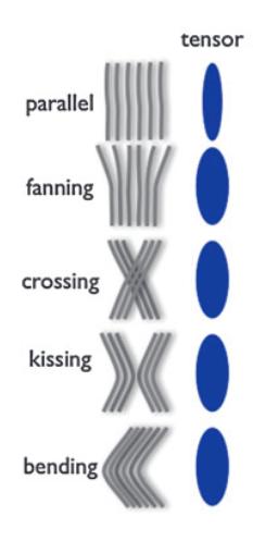 DTI Visualizaton Project